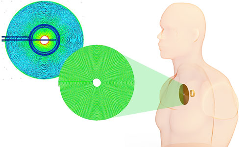 WPT FEA for Biomedical Implants: Coupling and Safety Analysis