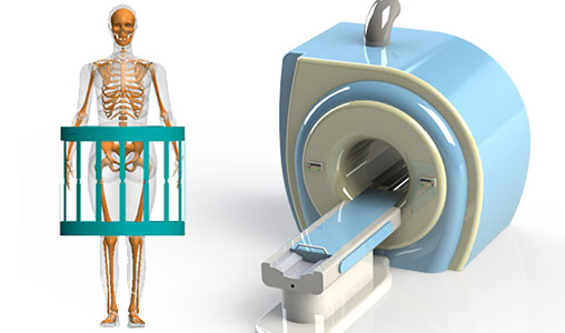MRI Safety FEA: SAR, RF Heating, and Static Force on Implants